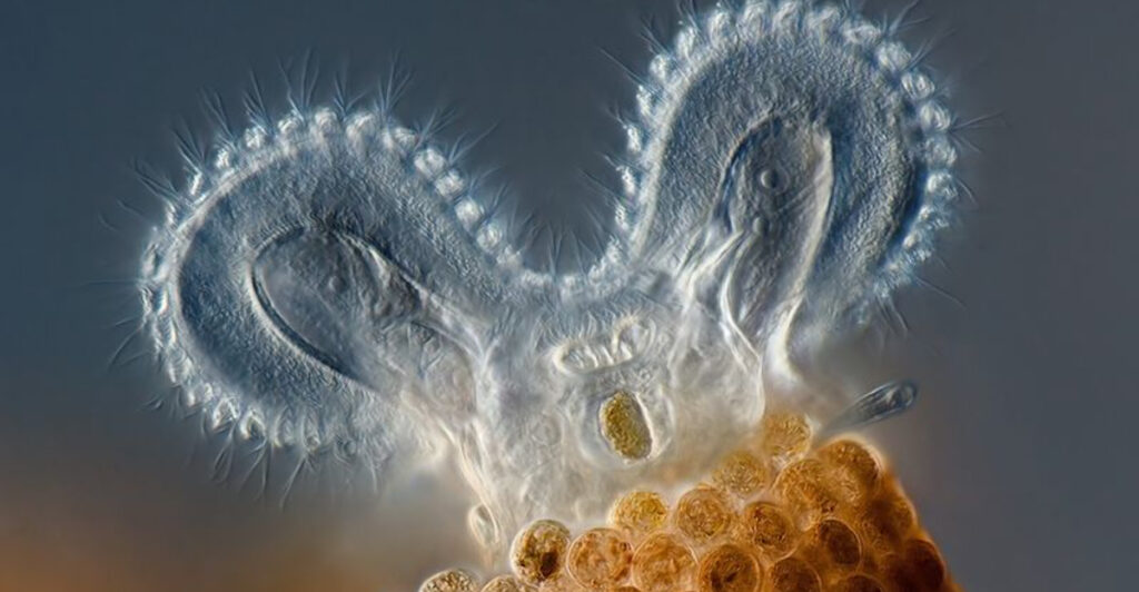 7 Incredible Images Of Animals Seen Under The Microscope