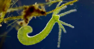 12 Animals That Live Without A Brain